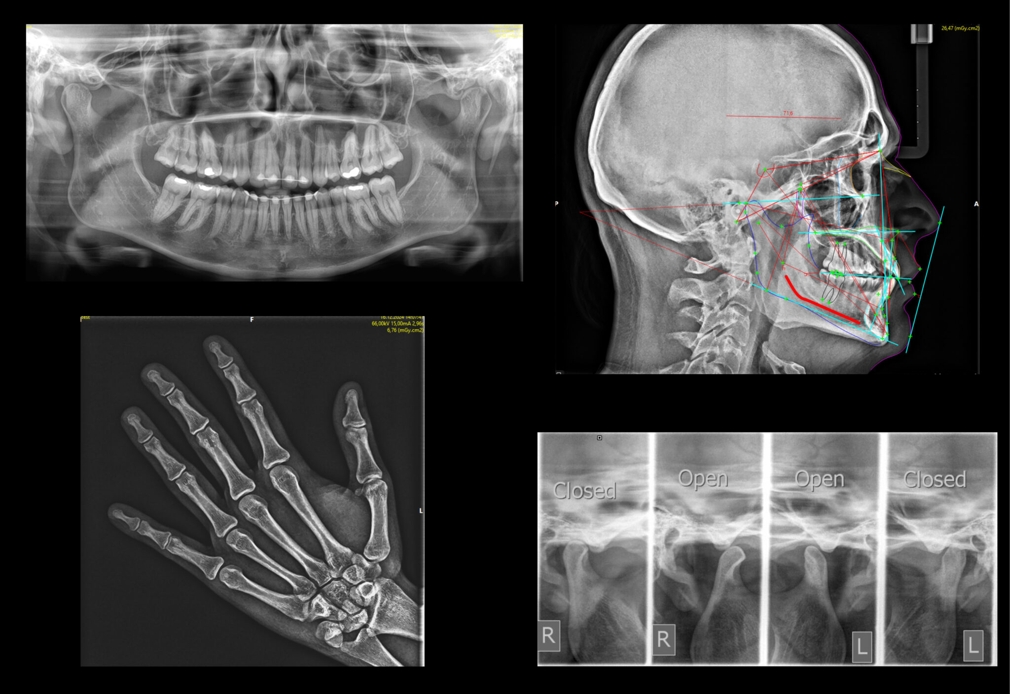 2D RTG – CBCT Praha